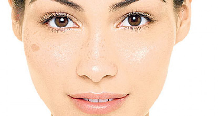 Dealing with discolouration