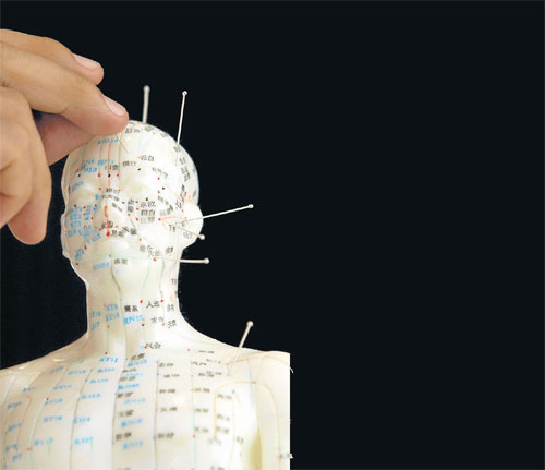 Bangkok Post - Hospital to host acupuncture workshop