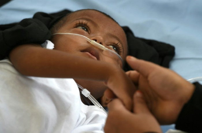 Bangkok Post - Experts warn of oxygen shortages in poor virus ...