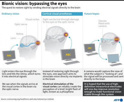 Scientists build implant that restores vision