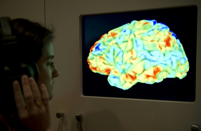 Bangkok Post - Scientists use brain scans and AI to 'decode' thoughts