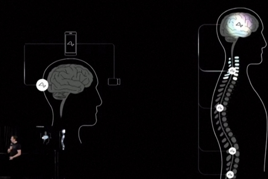 Bangkok Post - Musk's Neuralink implants brain chip in first human