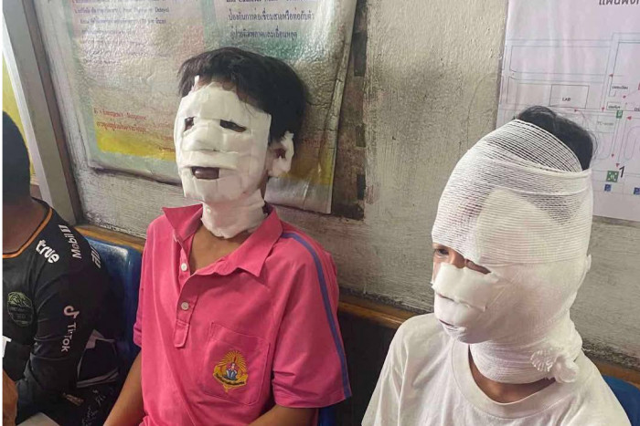 Students burned by teacher's science experiment Bangkok Post Learning ...