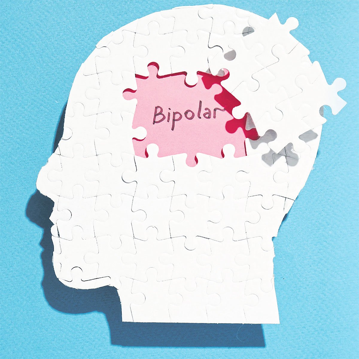 Bangkok Post - Bipolar disorder may have connection to gut-brain axis