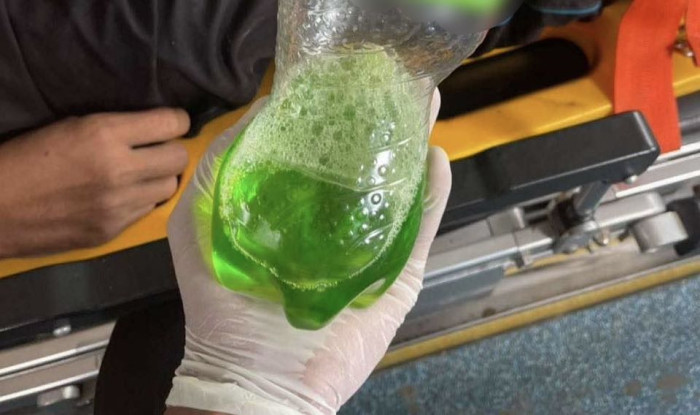 Bangkok Post - Man dies after mistakenly drinking toilet cleaner from ...
