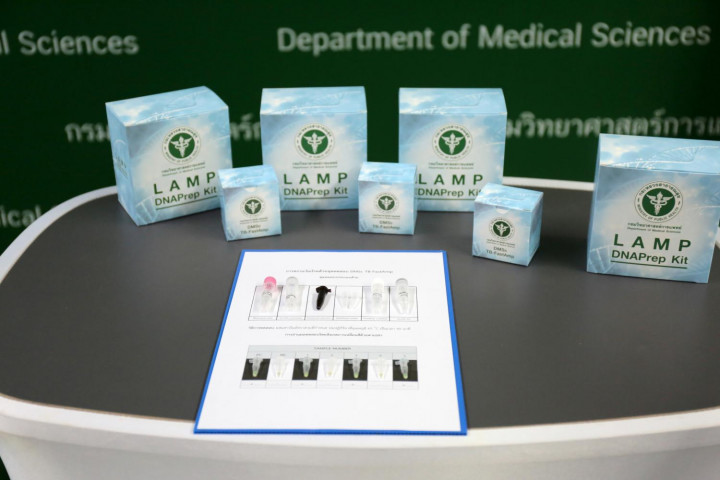 Bangkok Post - New TB kit to curb spread